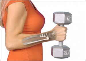 Aptis Medical | Creators of the Aptis DRUJ prosthesis